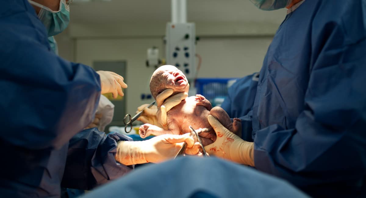 What Are the Most Common Birth Injuries? - Greer Injury Lawyers ...